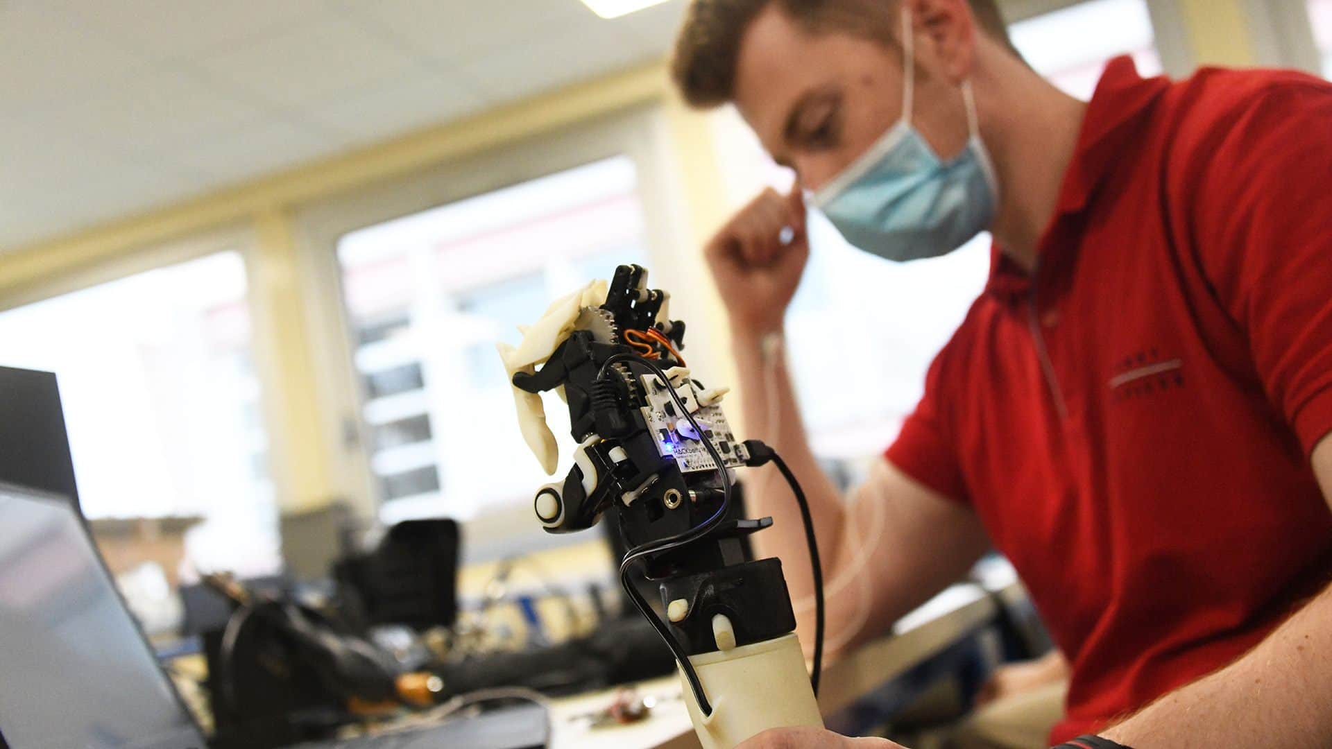 Mulhouse : une prothèse de main intelligente développée par l’IUT | m2A ...
